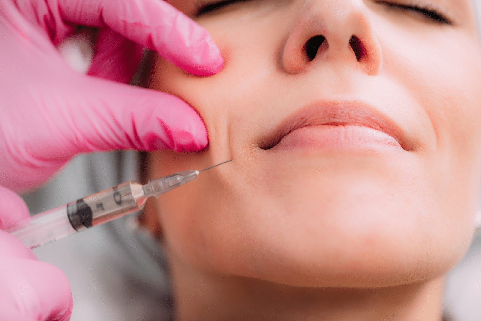 Types of Dermal Fillers: Uses, Differences, and Risks Explained