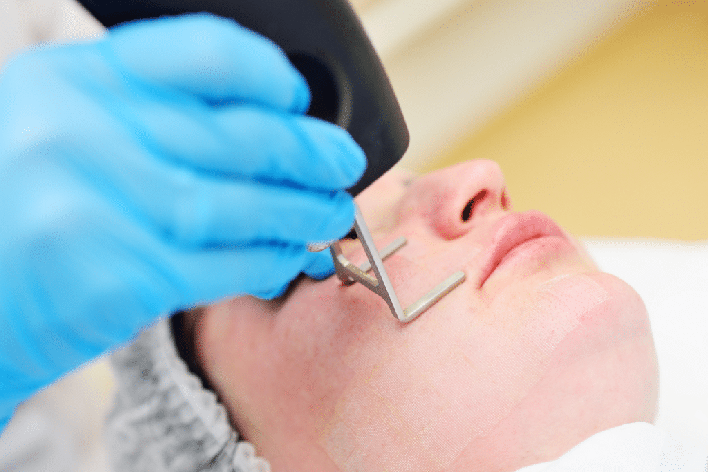 Types of Laser Treatments: How They Work & Their Uses (2025)